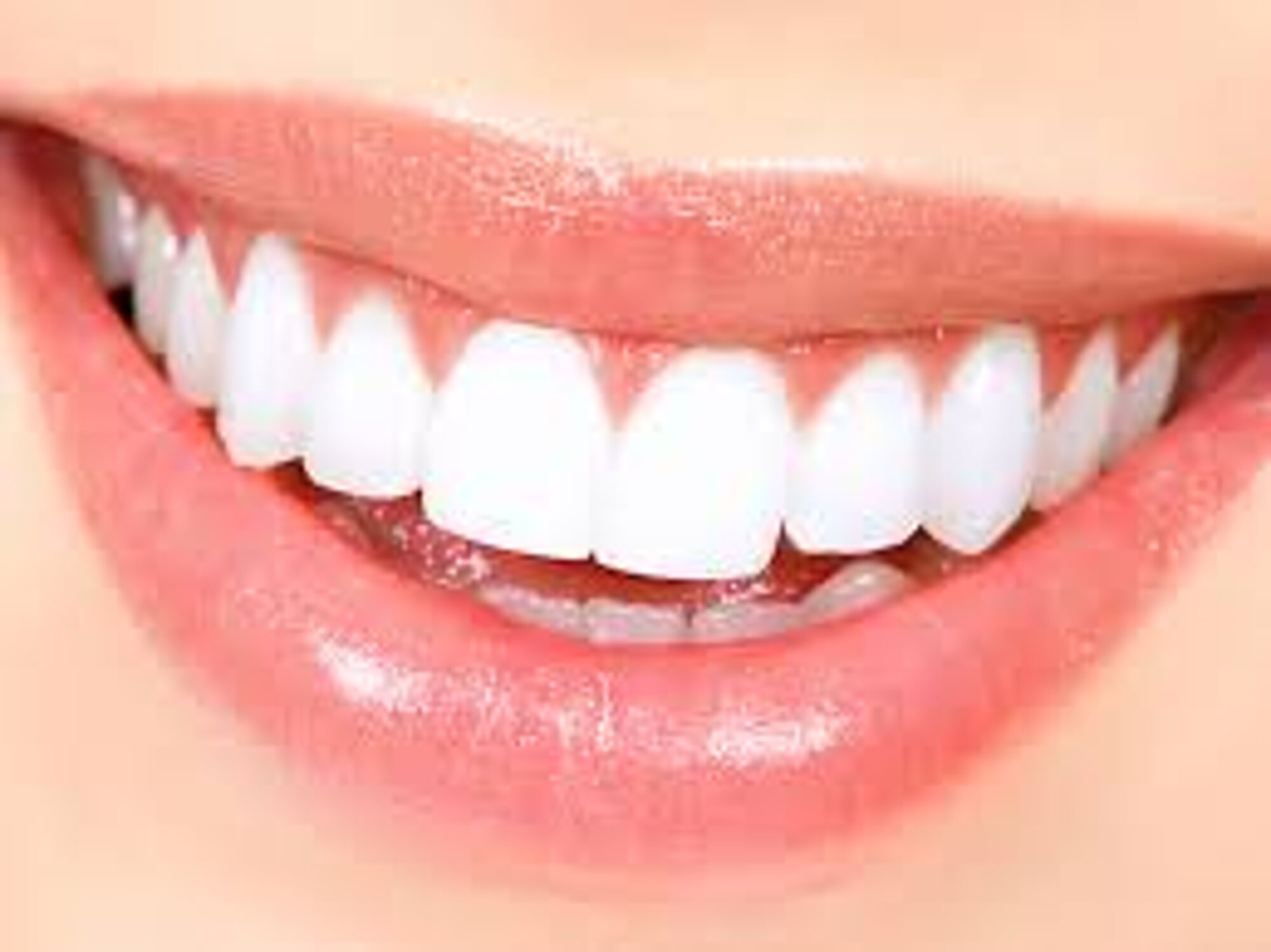 Singing Dentist - Tooth Whitening | News | Adentica Family Dentists ...